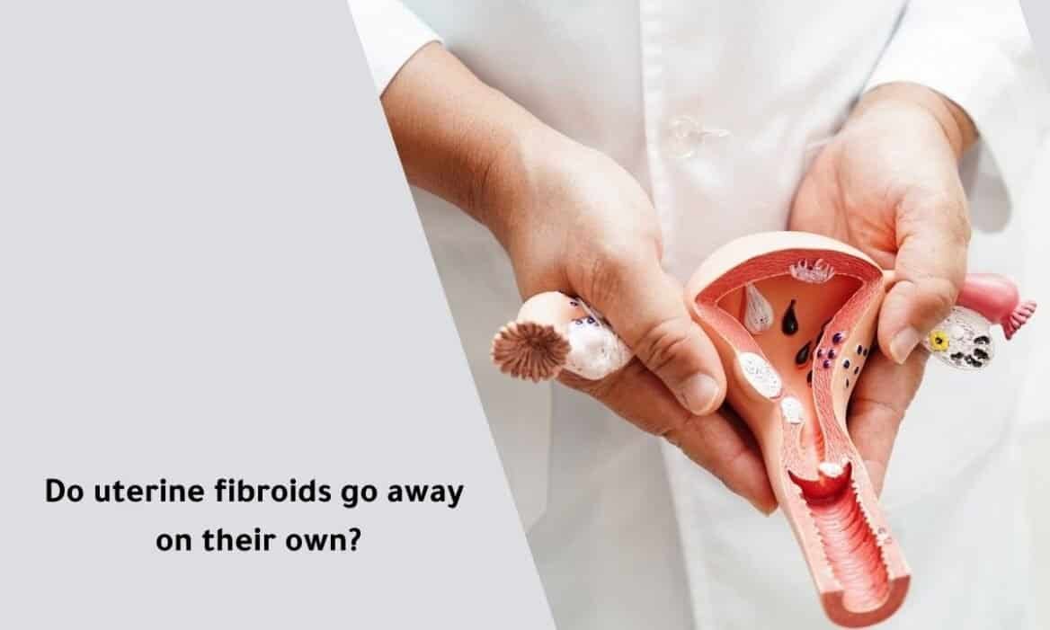 Understanding Endometriosis and Uterine Fibroids - London Fibroid Clinic